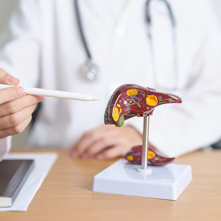 Doctor Vikatan: `பித்தப்பை கற்கள்' அறுவை சிகிச்சையைத் தவிர்க்க சித்த ...