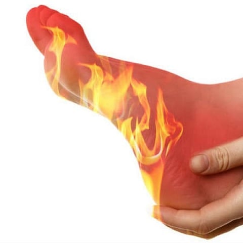 Feet Burn – Symptoms & Causes - Vikatan