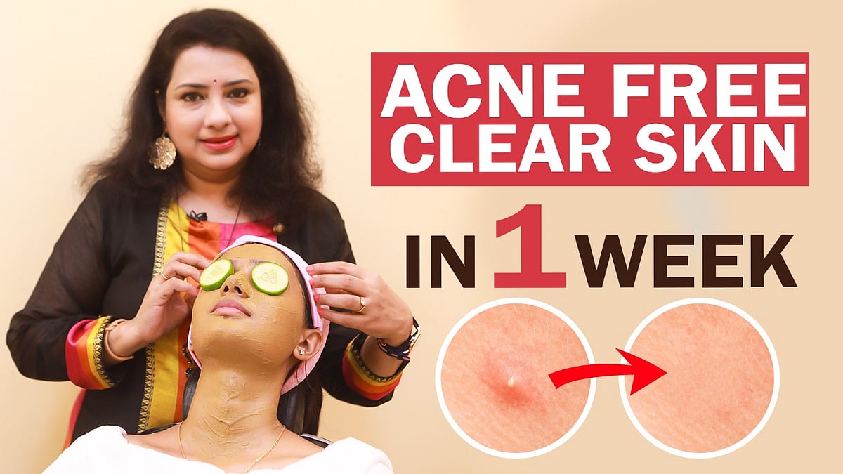 Remove Pimple & Acne in 1 week | Easy Facepack | Overnight | Pimple ...