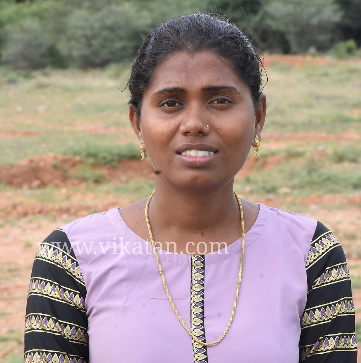 ``பாலின மாற்று அறுவை சிகிச்சையின் சிக்கல்கள் சரிசெய்யப்படணும் ...