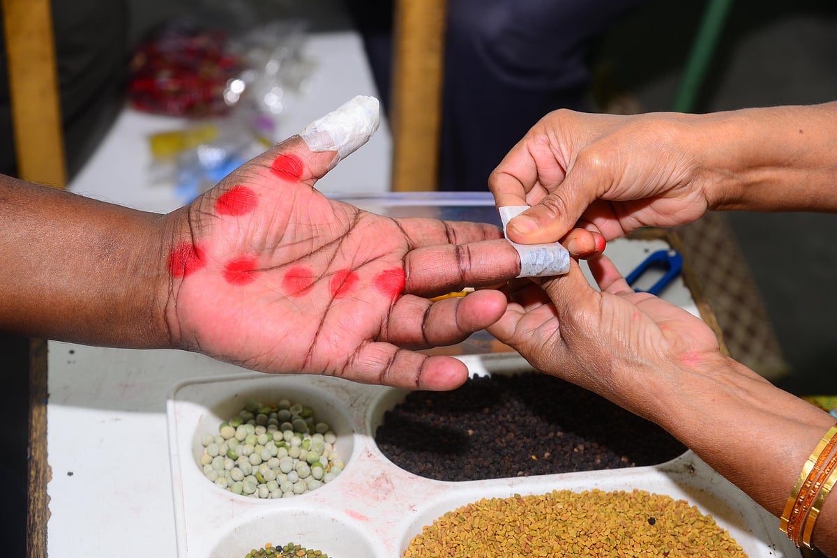 வர்மப் புள்ளி வைத்தியத்தால் என்னென்ன நன்மைகள் உண்டாகும் தெரியுமா ...