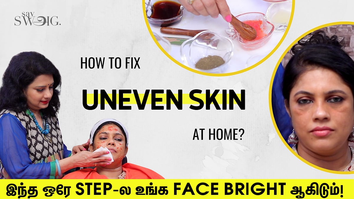 Face-ல ஒரு இடம் மட்டும் கருப்பா இருக்கா? Pigmentation & Uneven Skin ...