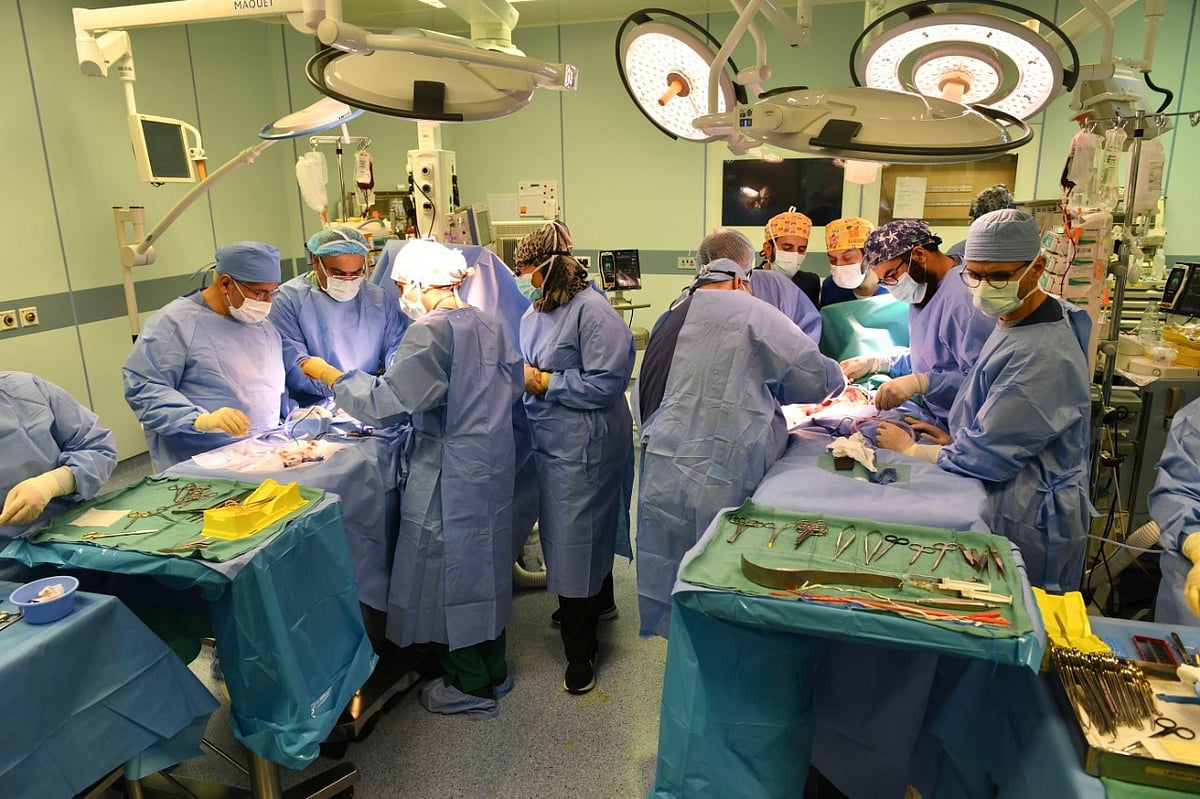 ஒட்டிப்பிறந்த இரட்டையர்கள்... 11 மணி நேர அறுவை சிகிச்சைக்கு பின் ...